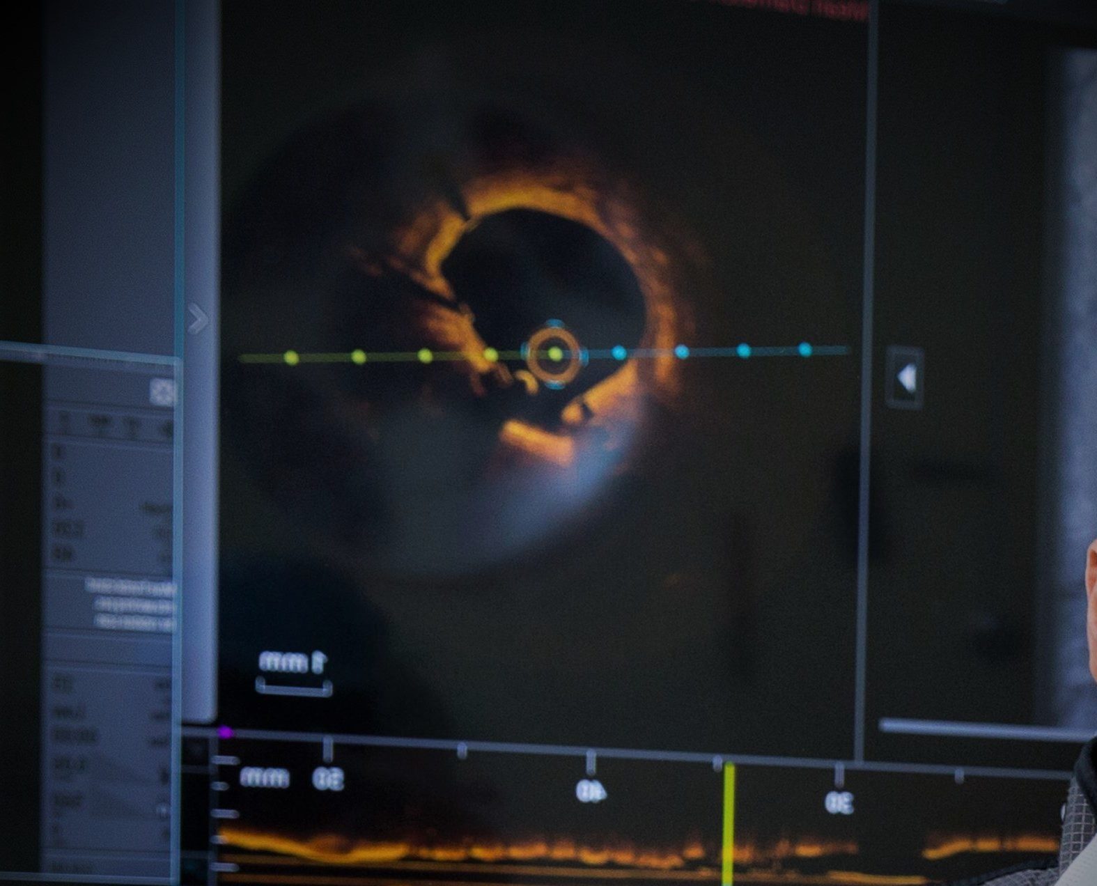 Research Coordinator II - PHRI